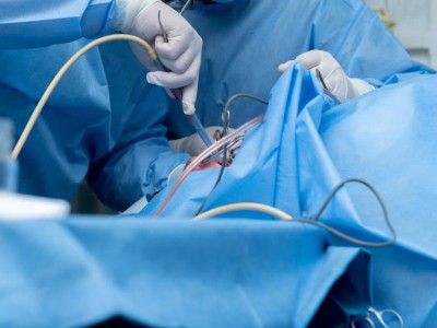 Kardiogener Schock und Stellenwert der temporären mechanischen ...