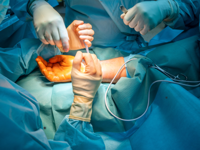 Strecksehnen | Tenolyse von Streck- und Beugesehnen an der Hand ...