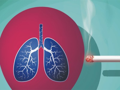 Allgemeinmedizin | Damit die Luft nicht ausgeht | springermedizin.at