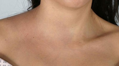 Blickdiagnosen | Seltene Ursache für einen dicken Hals | springermedizin.de