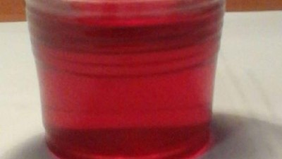 Pädiatrische Nephrologie | Erst Spaziergang, dann roter Urin ...