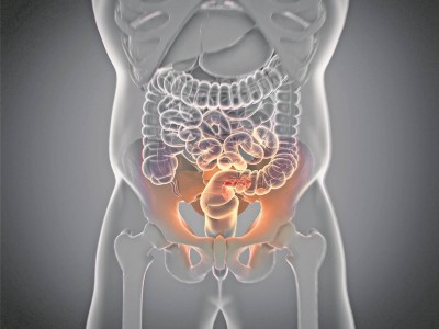 Onkologische Therapie | Funktionelle Störungen am Enddarm nach ...