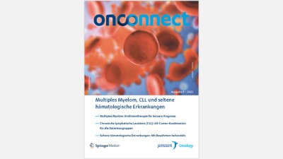 Hämatologische Neoplasien | Onconnect: Aktuelles aus der Hämato-Onkologie | springermedizin.de