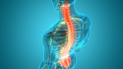 Preserved spinal tissue bridges may predict sensorimotor recovery after ...