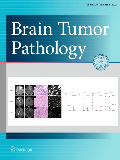 Astrocytoma | The 2021 WHO classification of tumors, 5th edition ...