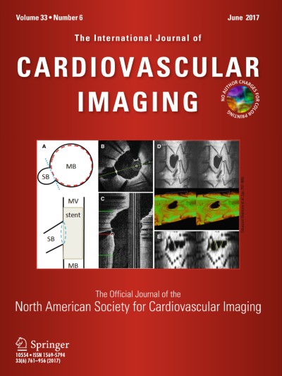 Left bundle-branch block contraction patterns identified from radial ...