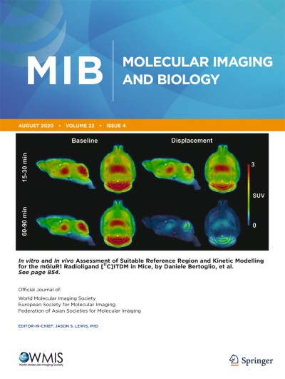 Computed Tomography | [99mTc]MIBI SPECT/CT for Identifying Dystonic ...