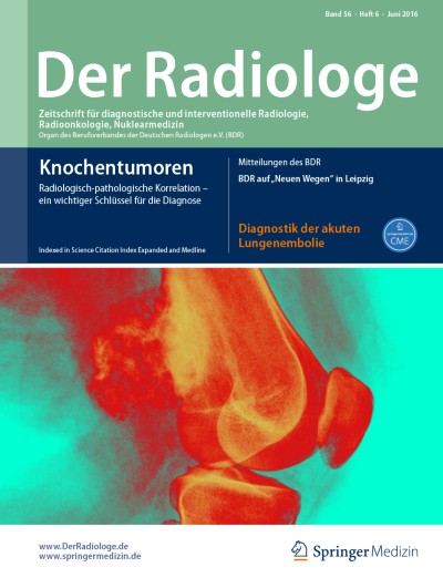 Knochentumoren | Ewing-Sarkom, fibrogene Tumoren, Riesenzelltumor ...