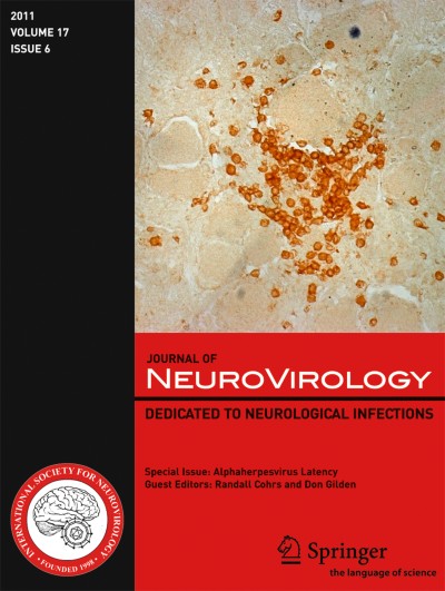 Varicella zoster virus-induced pain and post-herpetic neuralgia in the ...