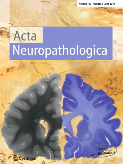 The Neuropathology Of Autism Defects Of Neurogenesis And Neuronal Migration And Dysplastic