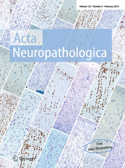 Neurodegeneration as a consequence of failed mitochondrial maintenance | springermedicine.com