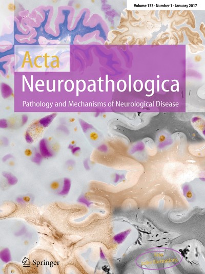 An updated histological classification system for multiple sclerosis lesions | springermedicine.com