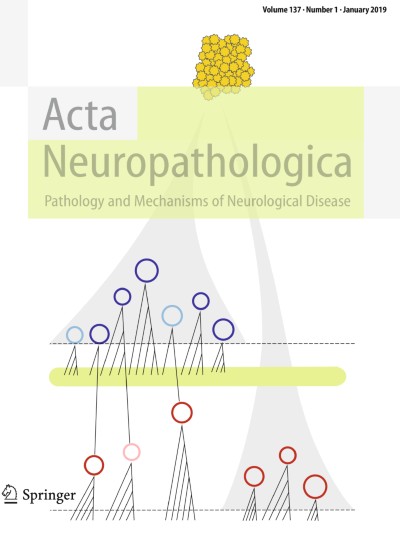 “Minimal change” multiple system atrophy with limbic-predominant α ...