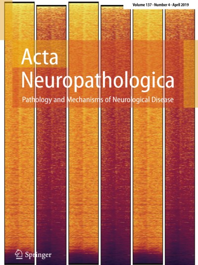 Brain Tumor | Translational control in brain pathologies: biological significance and ...