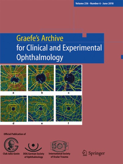 Inverted internal limiting membrane flap technique for large macular ...
