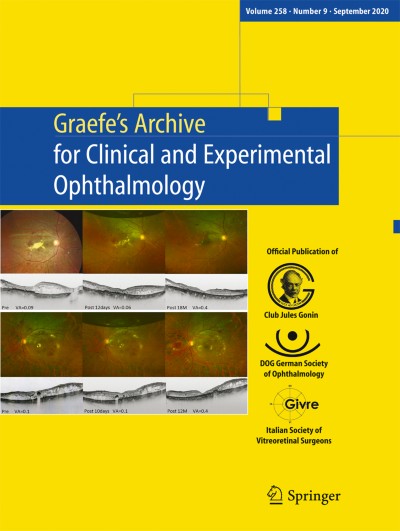 Vitrectomy | Effects of inverted internal limiting membrane technique and insertion technique on ...
