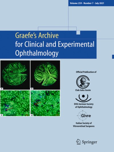 Glaucoma | May ganglion cell complex analysis be a marker for glaucoma ...
