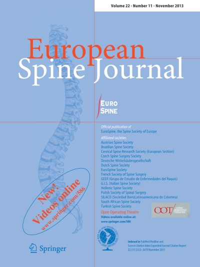Transverse plane 3D analysis of mild scoliosis | springermedicine.com