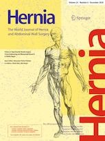 Anti-inflammatory coating of hernia repair meshes: a 5-rabbit study ...