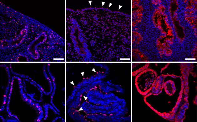 Collections | Cell Death & Differentiation