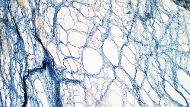 Collections | npj Biological Physics and Mechanics