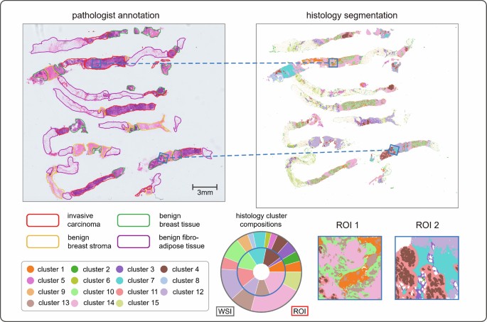 Smart spatial omics (S2-omics) optimizes region of interest selection ...