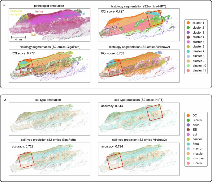 Smart spatial omics (S2-omics) optimizes region of interest selection ...