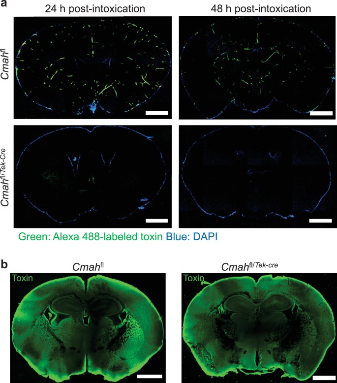 Typhoid toxin causes neuropathology by disrupting the blood–brain ...