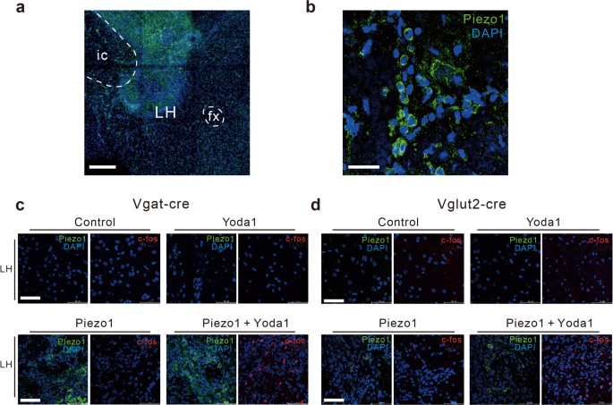 In vivo magnetogenetics for cell-type-specific targeting and modulation ...