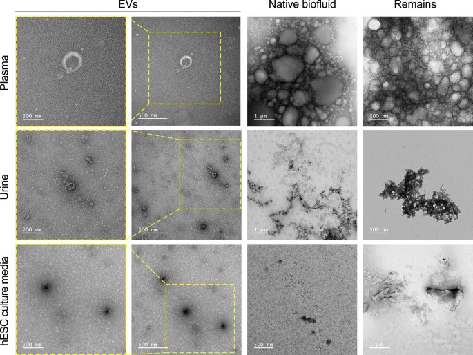 Meso–macroporous hydrogel for direct litre-scale isolation of ...