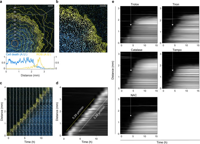 Emergence of large-scale cell death through ferroptotic trigger waves ...