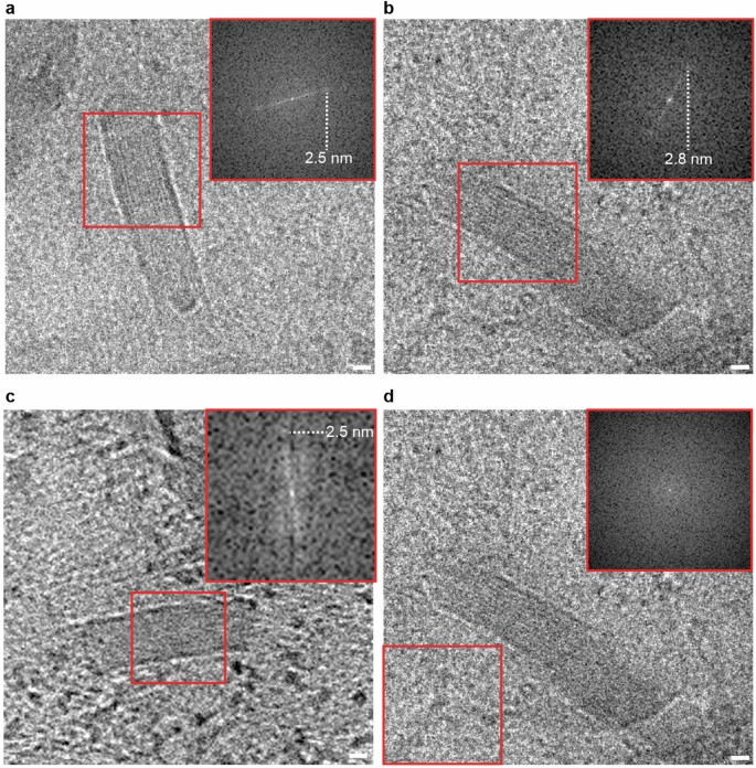 CryoET of β-amyloid and tau within postmortem Alzheimer’s disease brain ...