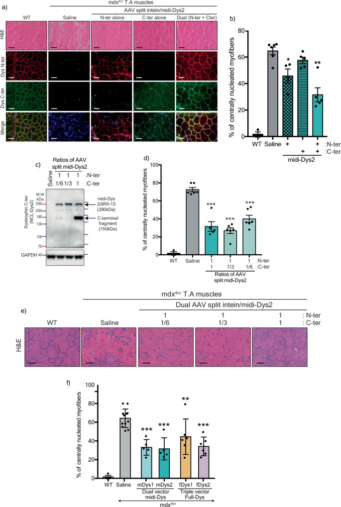 Split intein-mediated protein trans-splicing to express large ...