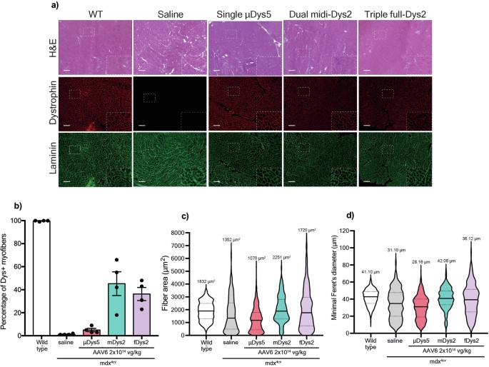Split intein-mediated protein trans-splicing to express large ...