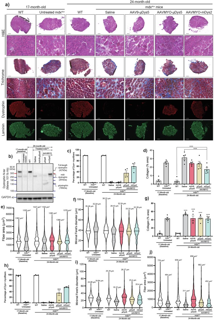 Split intein-mediated protein trans-splicing to express large ...