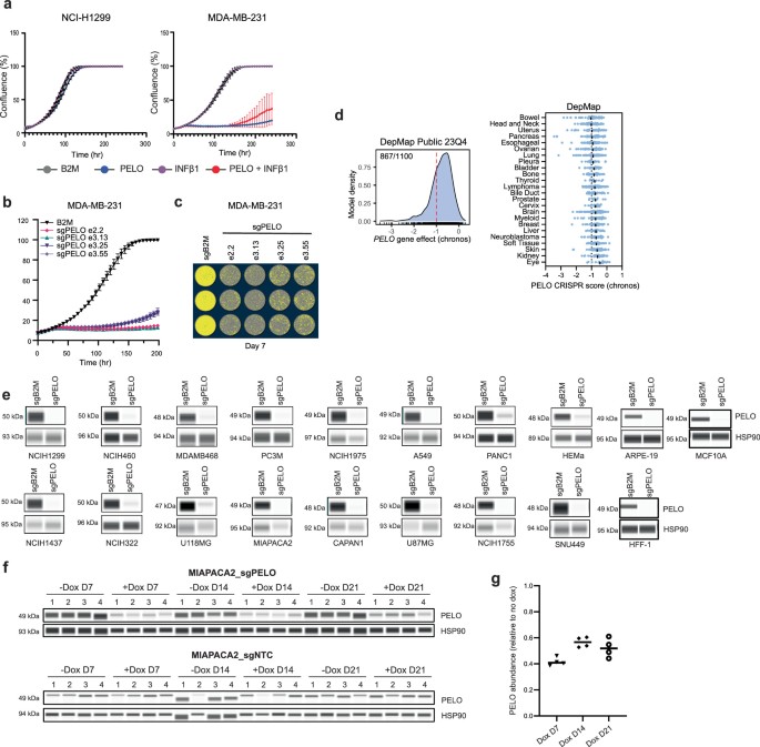 Synthetic lethality of mRNA quality control complexes in cancer | Nature