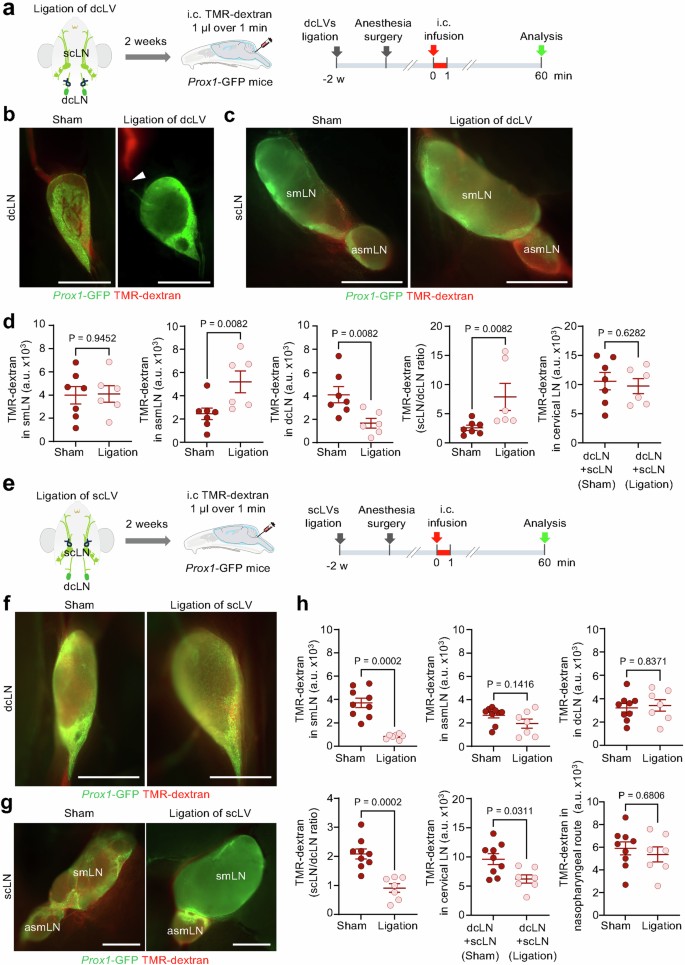 Increased CSF drainage by non-invasive manipulation of cervical ...