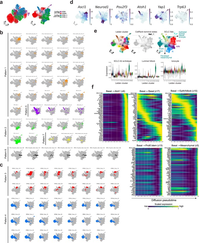 Basal cell of origin resolves neuroendocrine–tuft lineage plasticity in ...