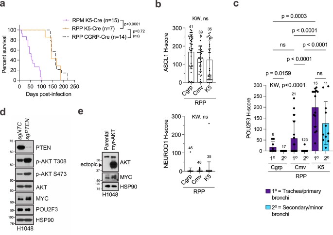 Basal cell of origin resolves neuroendocrine–tuft lineage plasticity in ...