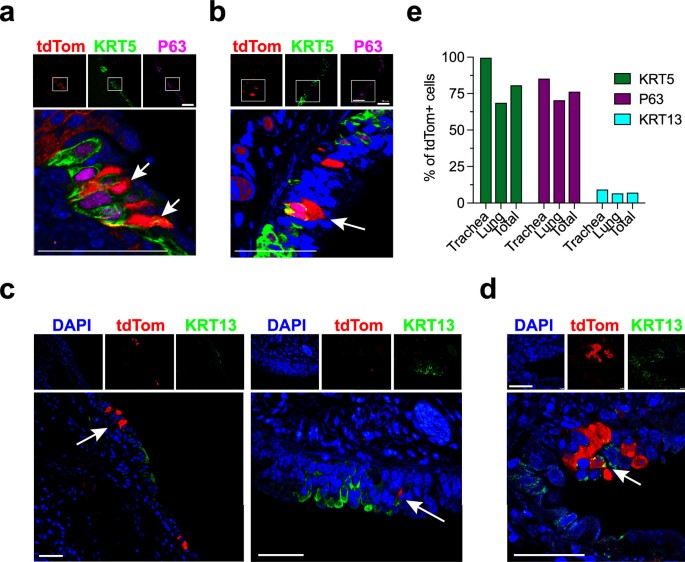 Basal cell of origin resolves neuroendocrine–tuft lineage plasticity in ...