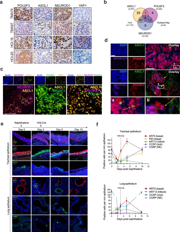 Basal cell of origin resolves neuroendocrine–tuft lineage plasticity in ...
