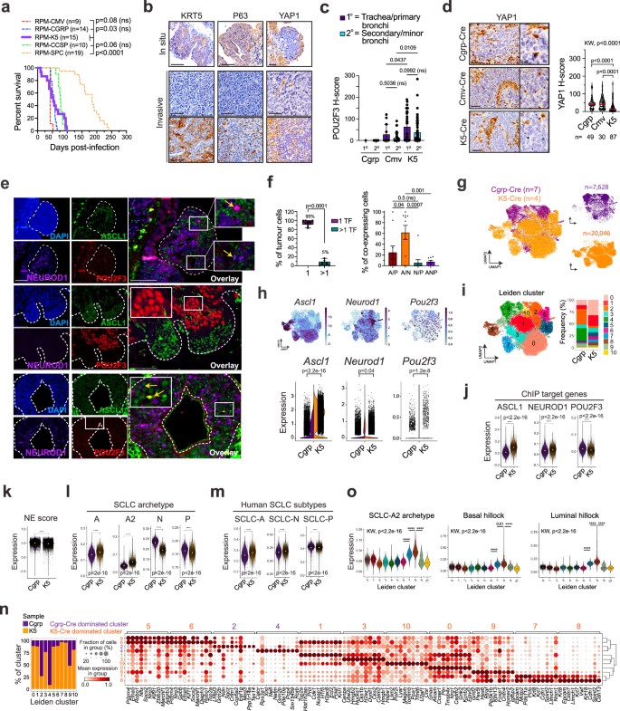Basal cell of origin resolves neuroendocrine–tuft lineage plasticity in ...