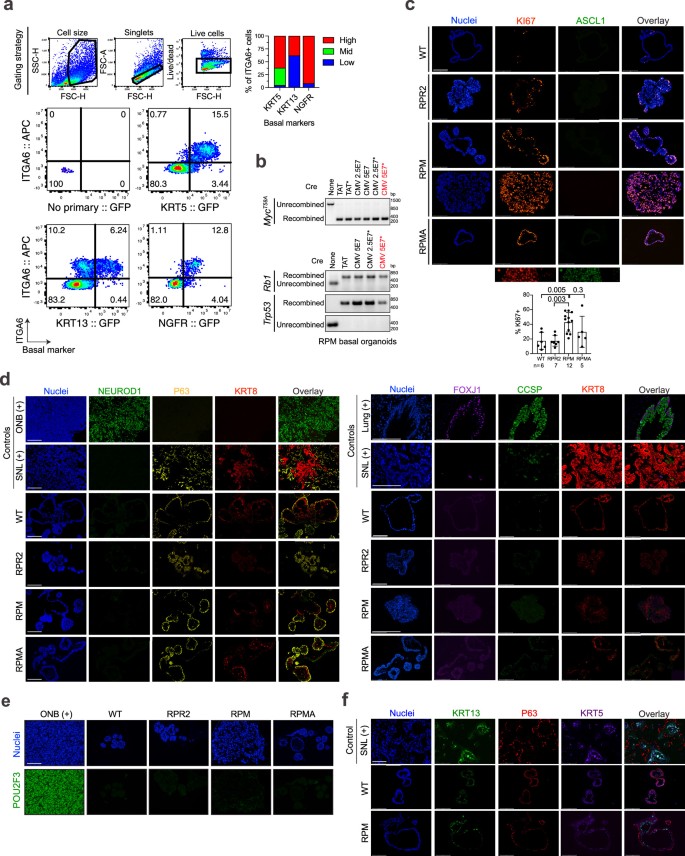 Basal cell of origin resolves neuroendocrine–tuft lineage plasticity in ...