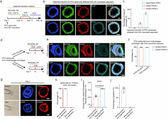 Human gastroids to model regional patterning in early stomach ...
