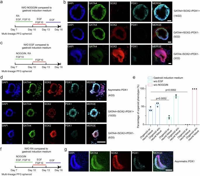 Human gastroids to model regional patterning in early stomach ...