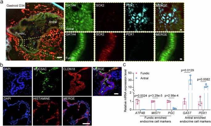 Human gastroids to model regional patterning in early stomach ...