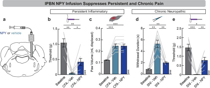A parabrachial hub for need-state control of enduring pain | Nature