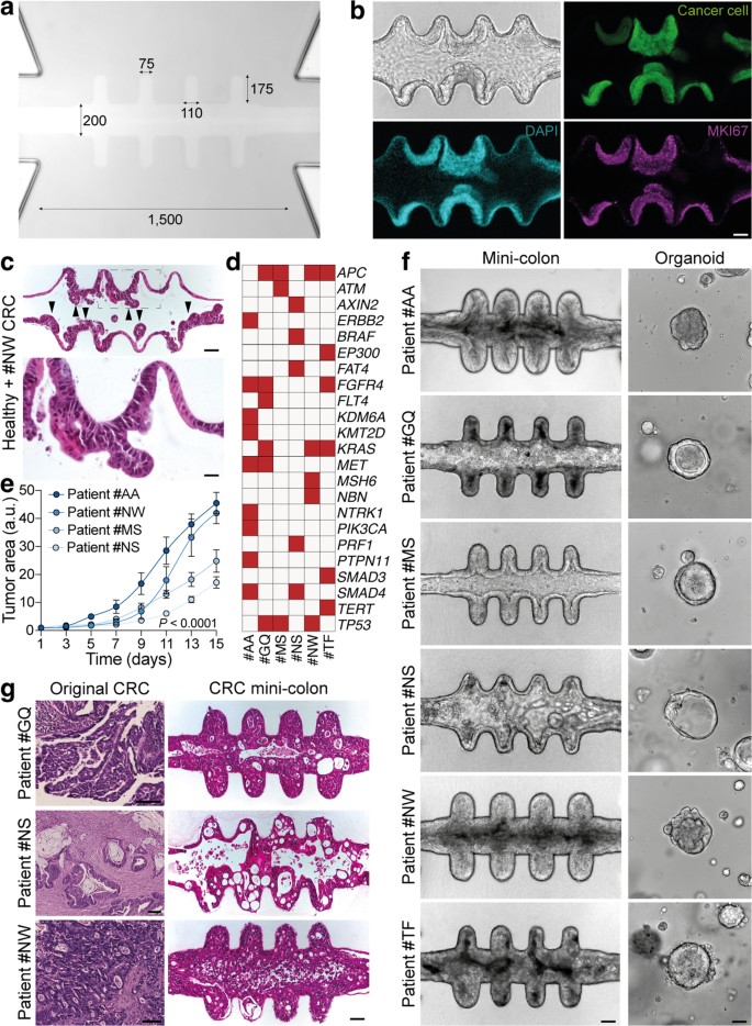 Patient-derived mini-colons enable long-term modeling of tumor ...