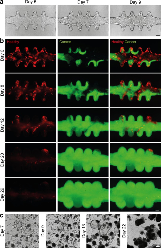 Patient-derived mini-colons enable long-term modeling of tumor ...