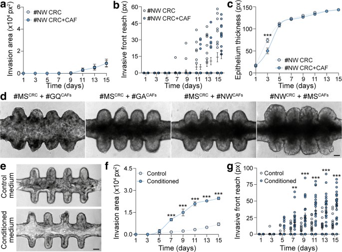 Patient-derived mini-colons enable long-term modeling of tumor ...